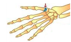 Perhatikan gambar berikut! Jenis sendi yang ...